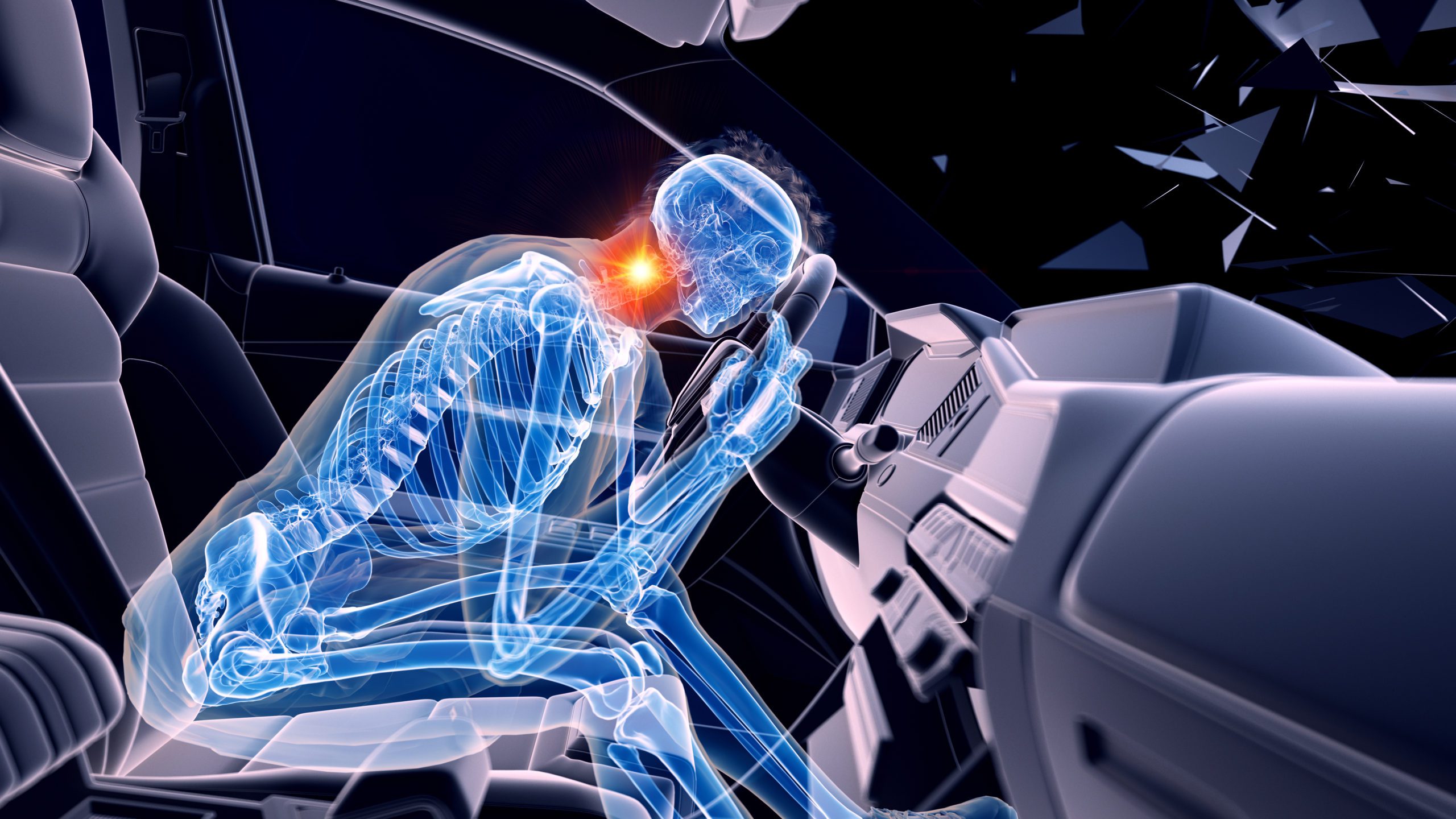 5 Things Car Accident Victims Need To Know About Spinal Cord Injuries ...